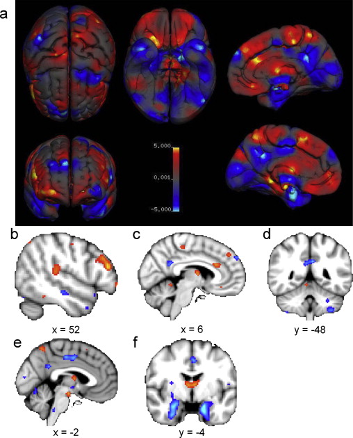 Cosmosophy Eeg Patterns Allow Sex Prediction With 80 Accuracy