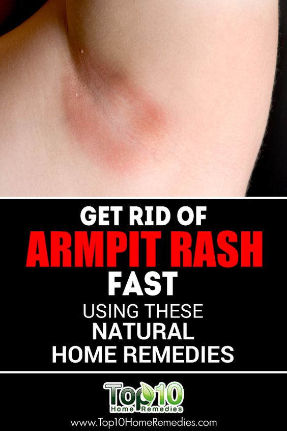 How To Heal Armpit Rashes Food Blog how-to-heal-armpit-rashes-food-blog