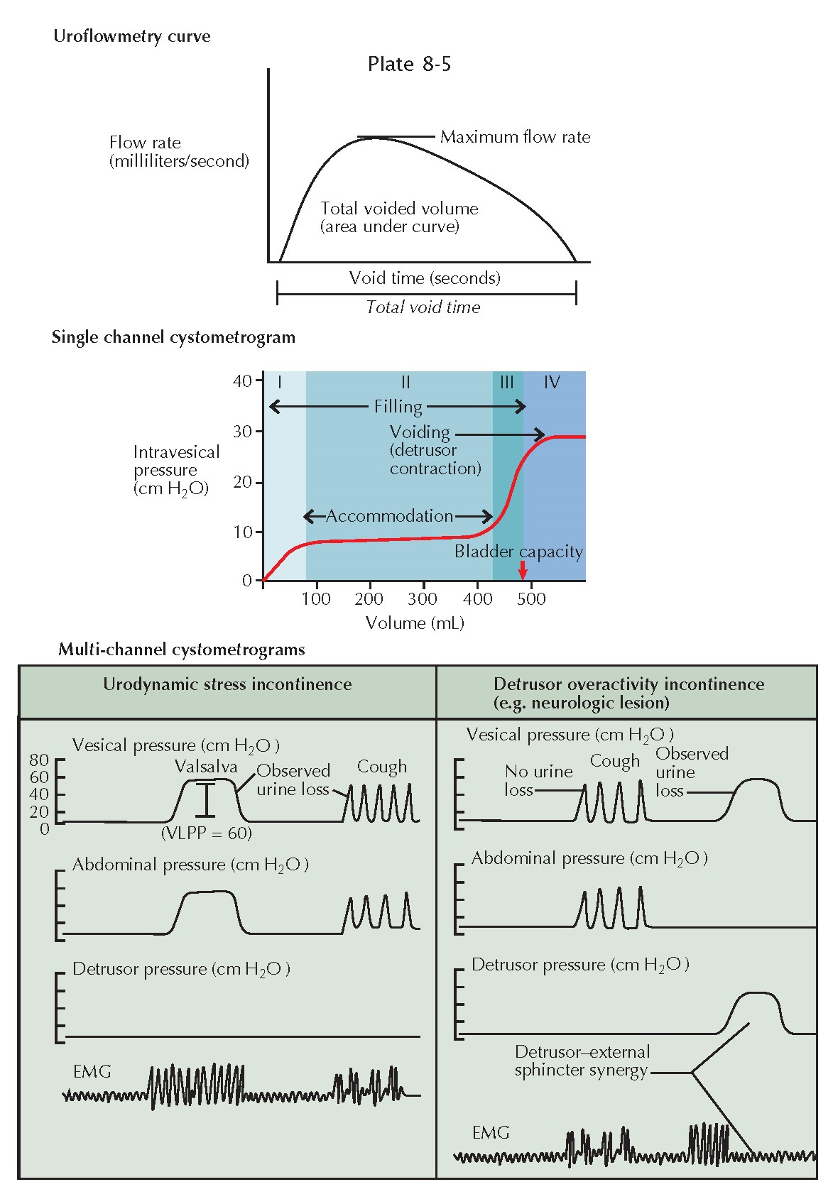 URODYNAMICS - pediagenosis