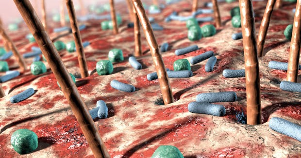 EM Didactic: Cellulitis Mimics