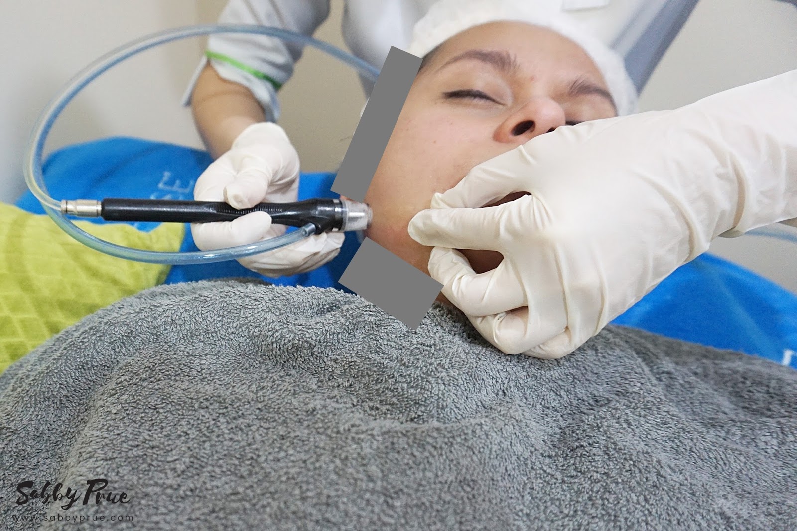 BEAUTY | Silkpeel Dermalinfusion at Revival Medical Clinic - ♥ Sabby ...