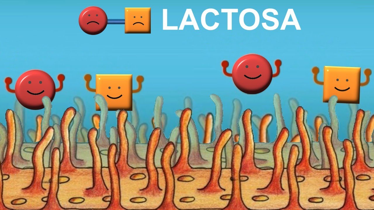 Doctor Gastro: Consejos Prácticos: Intolerancia a la lactosa