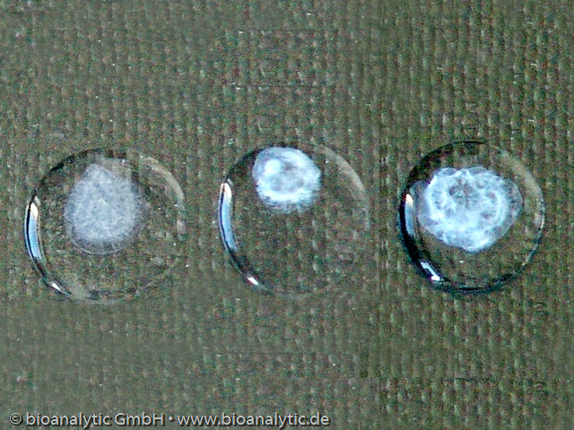 Pemeriksaan LCS Metode None-Pandy ~ Medical Laboratory Technologist