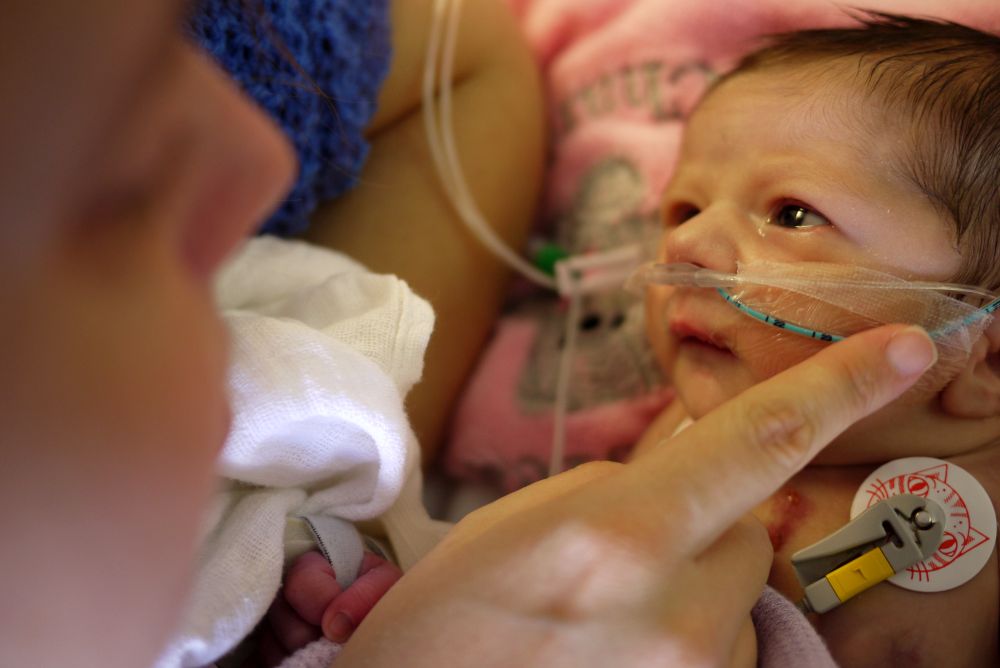 Jessica's Journey: Day 9 - Second post-birth operation