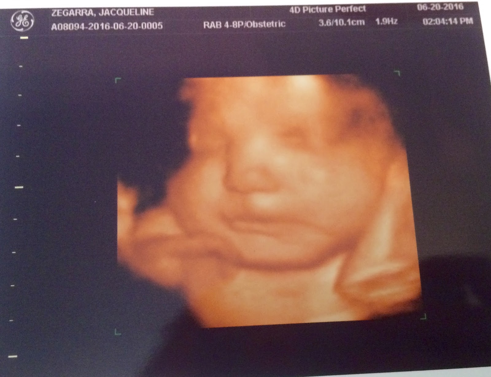 Loved You Then, Love You Still, Always Have & Always Will : 33 Weeks