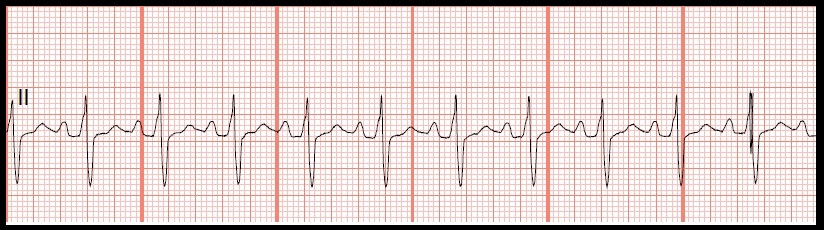 Basic EKG Rhythm Test 09