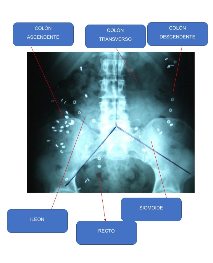PROTOCOLOS ESTUDIOS ESPECIALES EN IMAGENOLOGIA