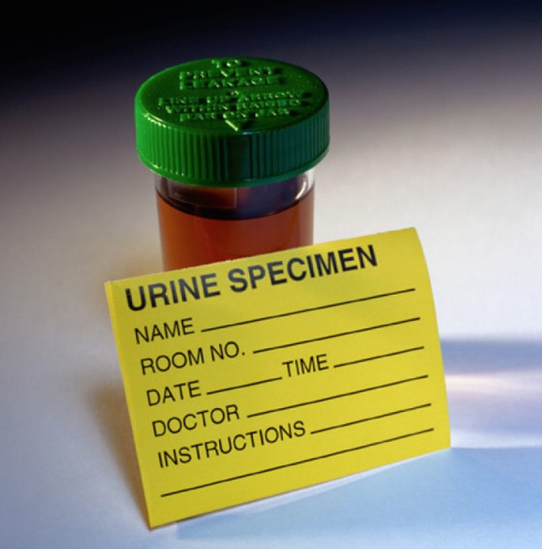 JT IRREGULARS Should Racine Unified Randomly Drug Test Students jt-irregulars-should-racine-unified-randomly-drug-test-students