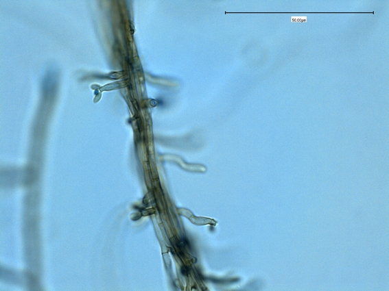 Fun With Microbiology (What's Buggin' You?): Fonsecaea pedrosoi/monophora
