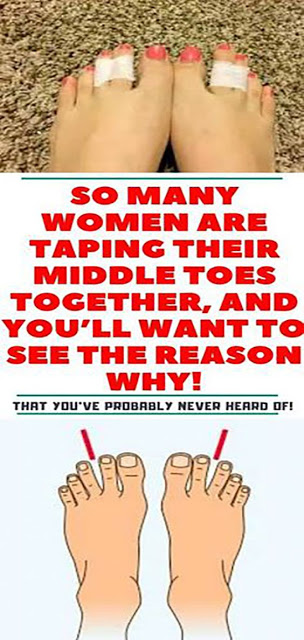 So Many Women Are Taping Their Middle Toes Together, And You’ll Want To ...