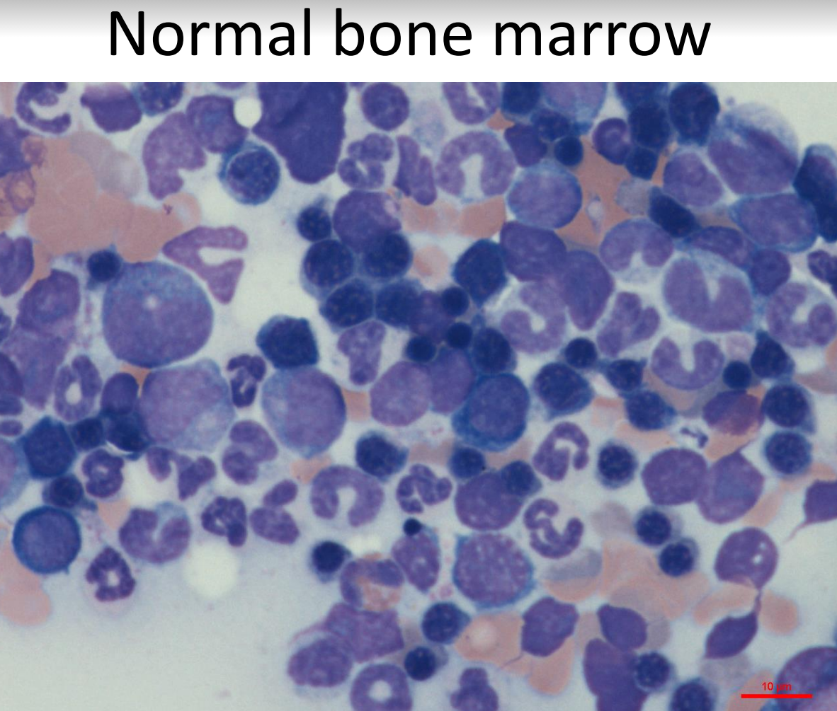 La Maison Boheme: Marrow | A New Commission