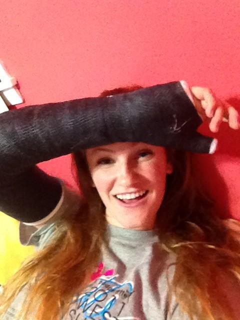 Casts and Toes: Arm Casts!!!