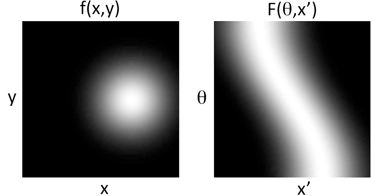 Intermediate Physics for Medicine and Biology: The Sinogram