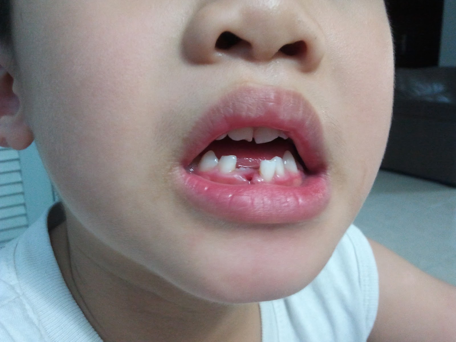 miawmiaw.com: Jaden's first fallen tooth