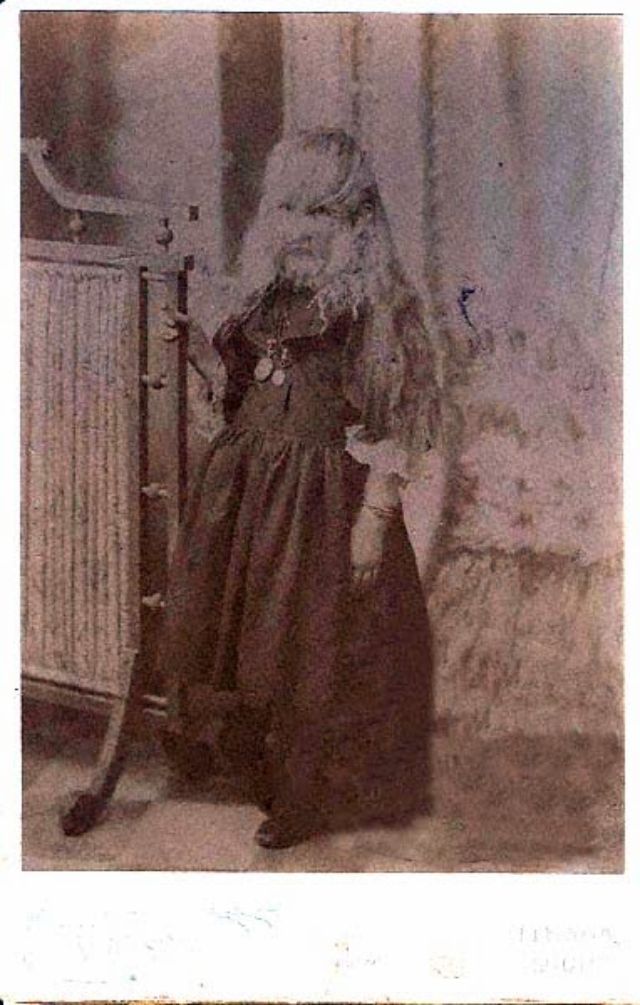 Amazing Vintage Photographs of the 'Minnesota Woolly Girl' Alice ...