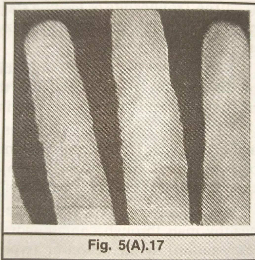 What is the different types of disease and their causes and symptoms of ...