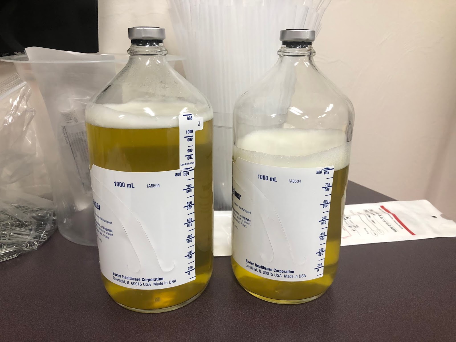 The Wilkins Way of Life: Another day, another thoracentesis