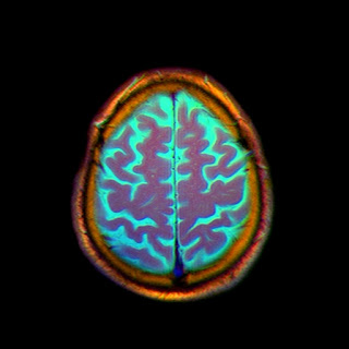 Nevit's blog: Color MRI of the Brain