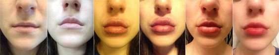 Natural Luscious Lips: How To Use CandyLipz Lip Pump Suction Device