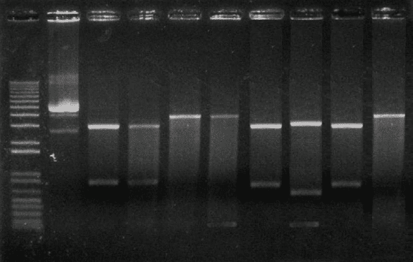 Biology: MENGENAL ELEKTROFORESIS