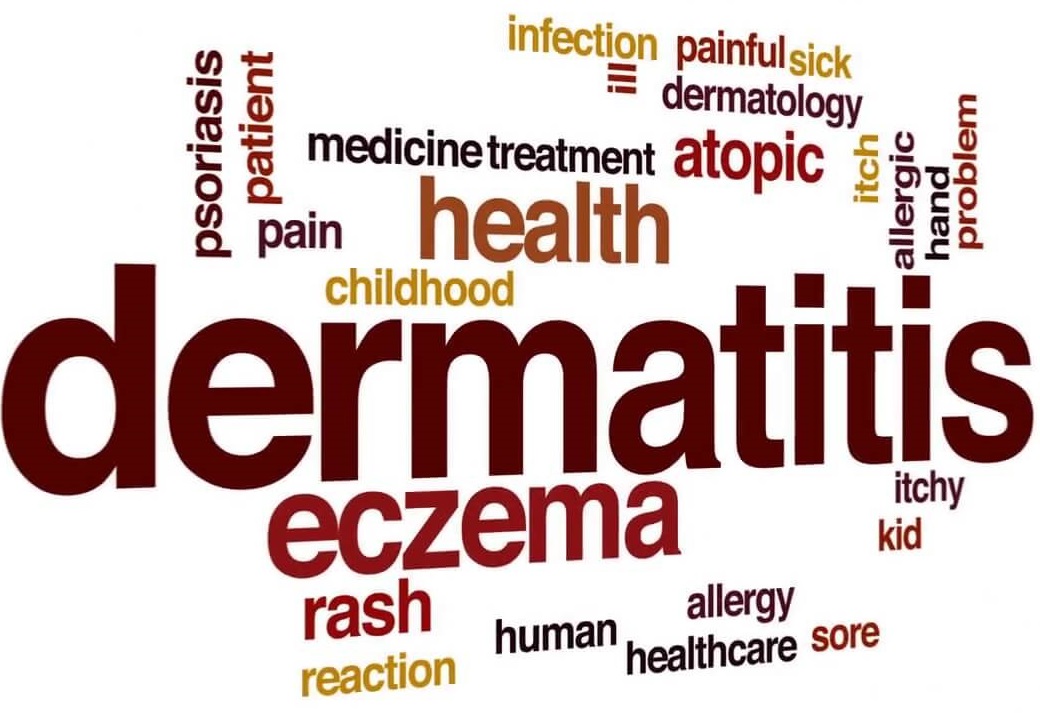 Skin Care Tips: Dermatitis: Diagnosis and Treatment