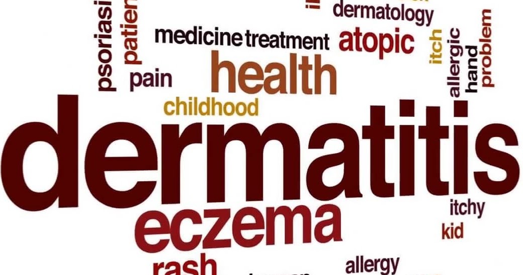 Skin Care Tips: Dermatitis: Diagnosis and Treatment