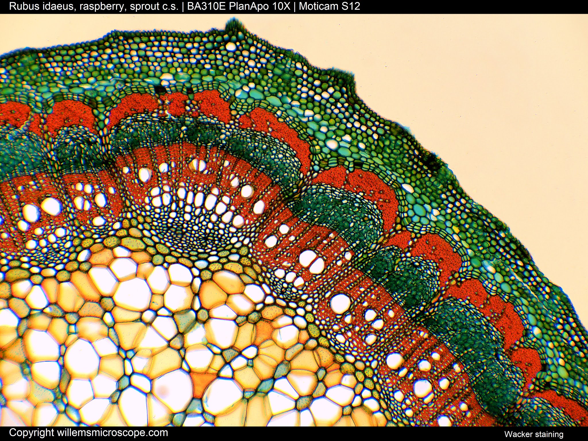 Motic Europe | Blog: Triple Stain Wacker 3A