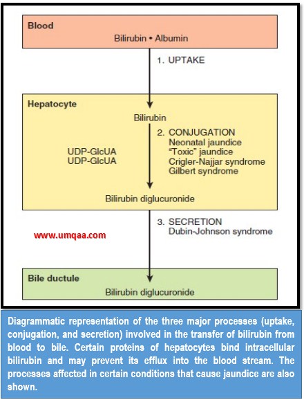 What is Gilbert's syndrome?