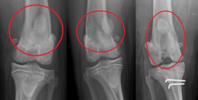 Nannis Welt: Krankheitsbild chronische Patellaluxation