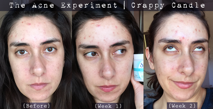 Exfoliation Before And After