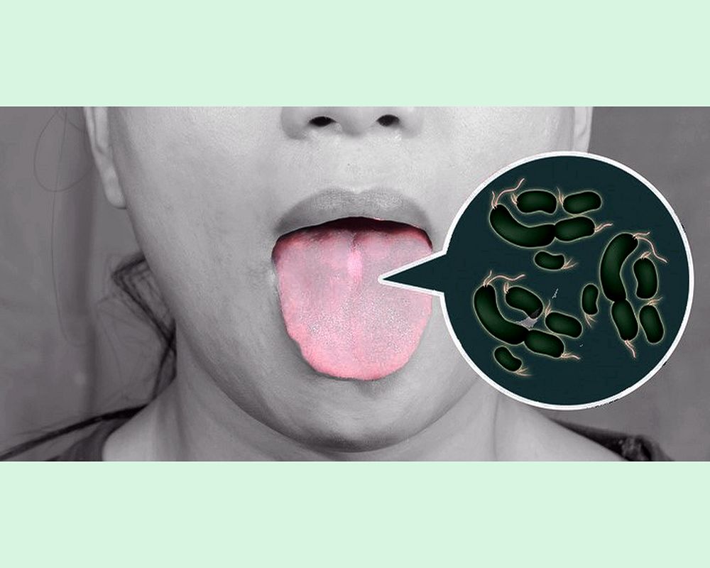 Conozca las 5 enfermedades bucales más comunes - OdontoVida