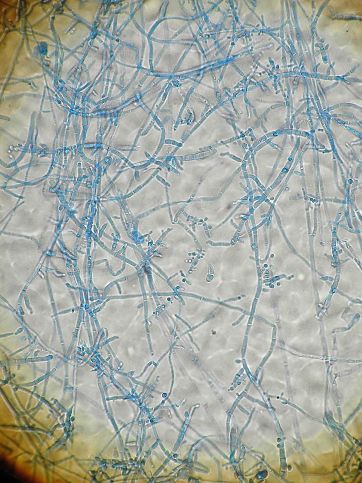 ATLAS MICOLOGIA: TRICHOPHYTON INTERDIGITALE
