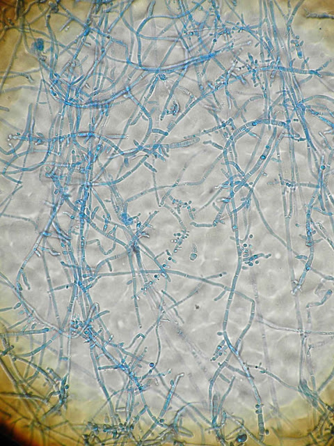 ATLAS MICOLOGIA: TRICHOPHYTON INTERDIGITALE