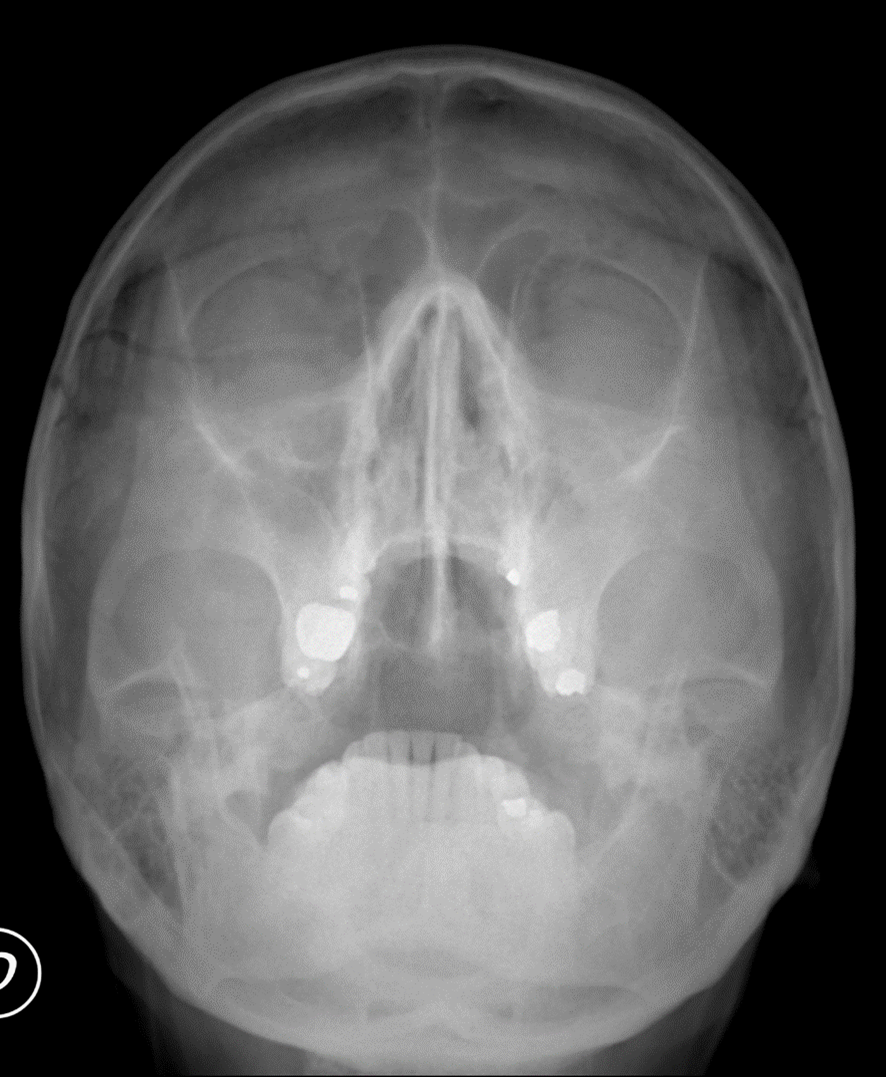 LABORATORIO DE IMÁGENES: 2017