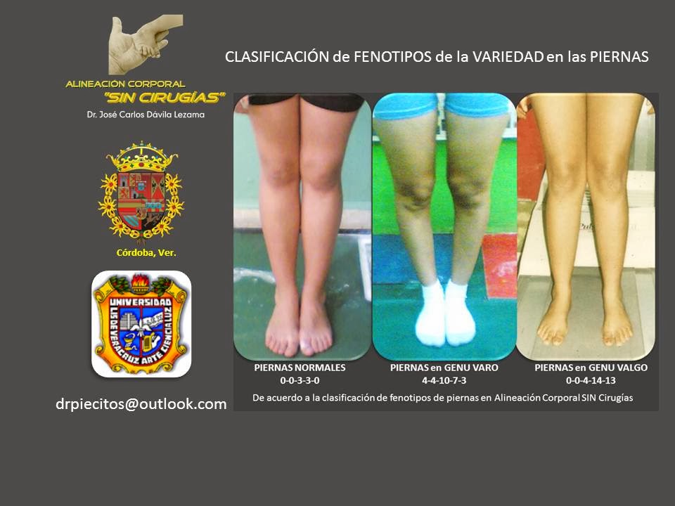 SIN CIRUGÍAS en LÍNEA: Medidas antropométricas normales de los miembros ...