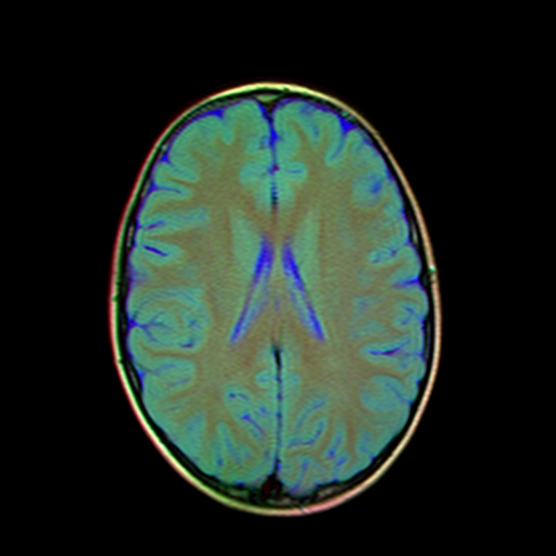 Nevit's blog: Color MRI of the Brain