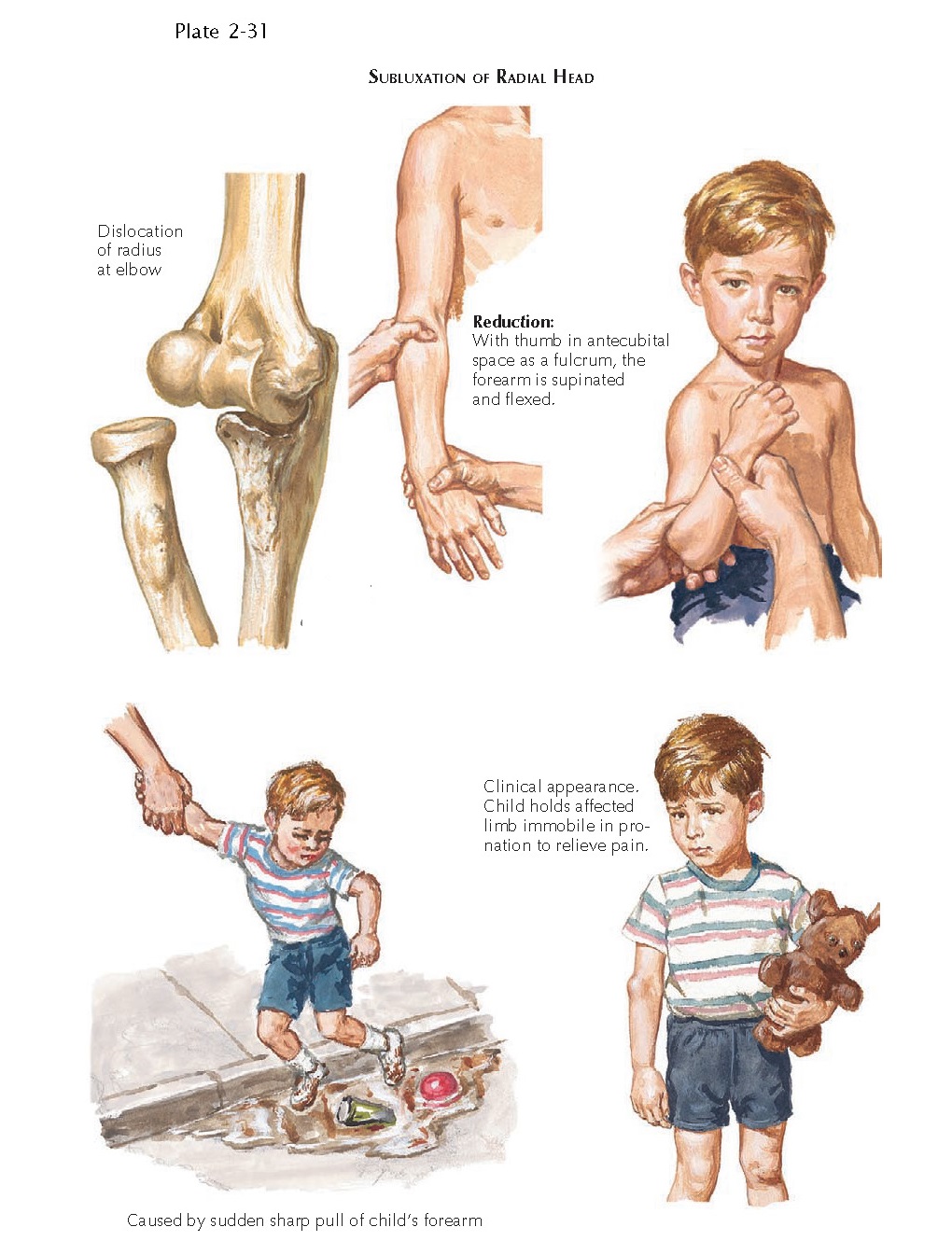 INJURIES IN CHILDREN - pediagenosis