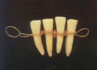 unimagdalena odontologica: HISTORIA DE LA ODONTOLOGIA