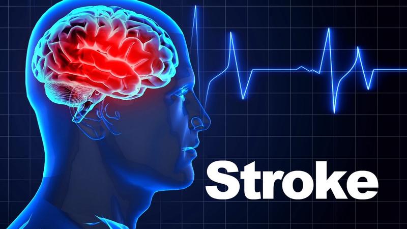 Stroke Symptoms Causes And Risk Factors Findyourself Findyourself343 Notes For Medical