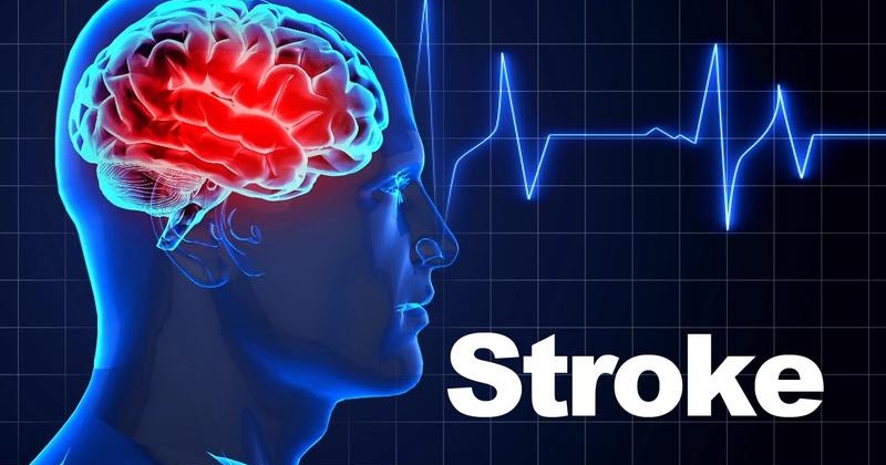 STROKE : SYMPTOMS:; CAUSES AND RISK FACTORS |FINDYOURSELF ...