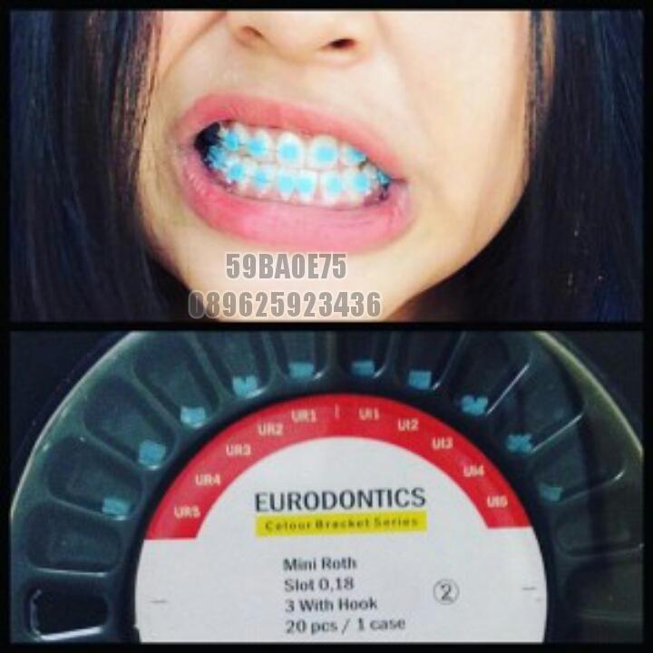 BEHEL EURODONTIC ~ BEHEL TANGERANG