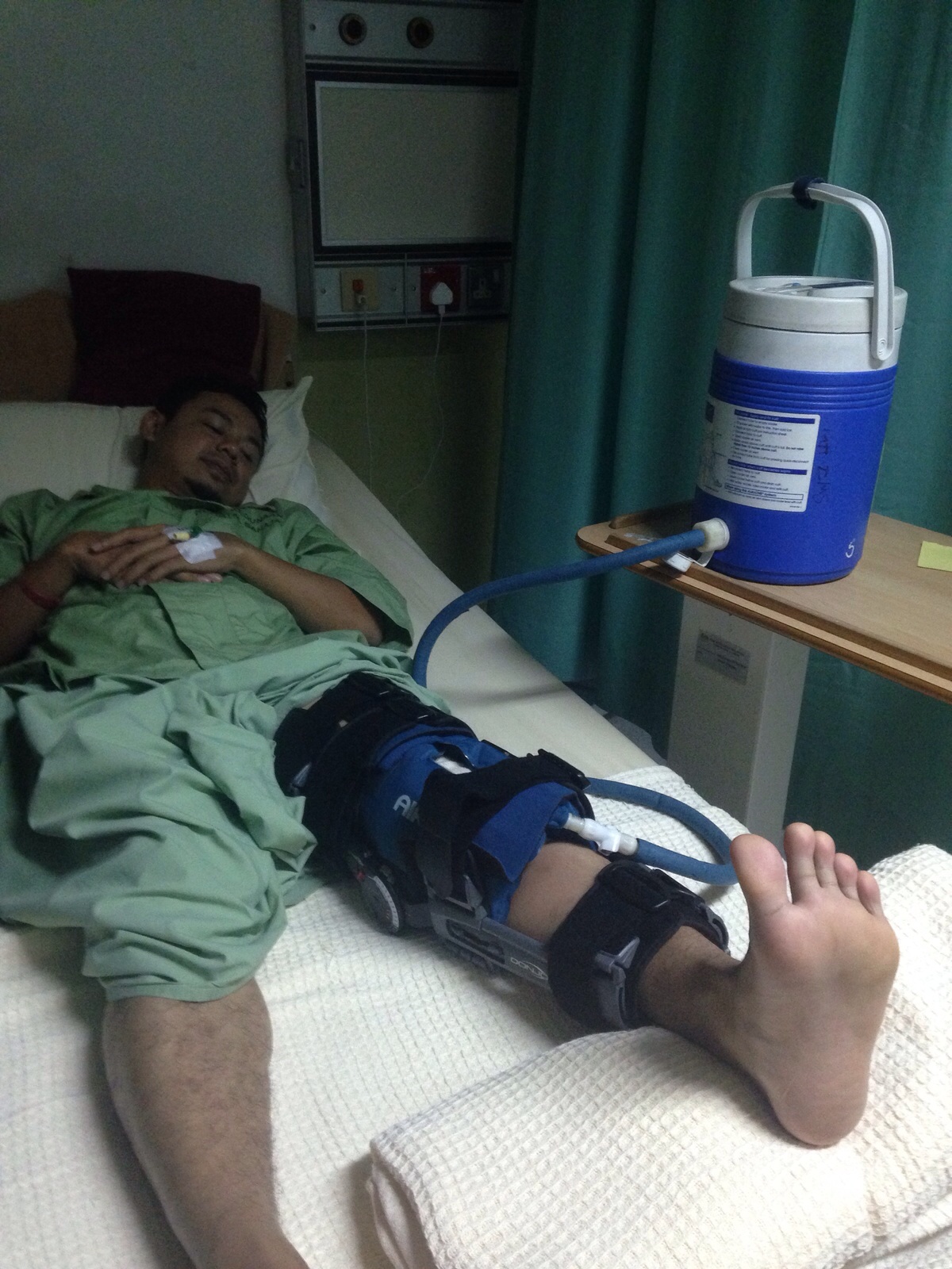 Dieyana: Apa Itu Pembedahan ACL?