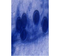 Parasitologi Kelompok 2 | WE LOVE 1A2