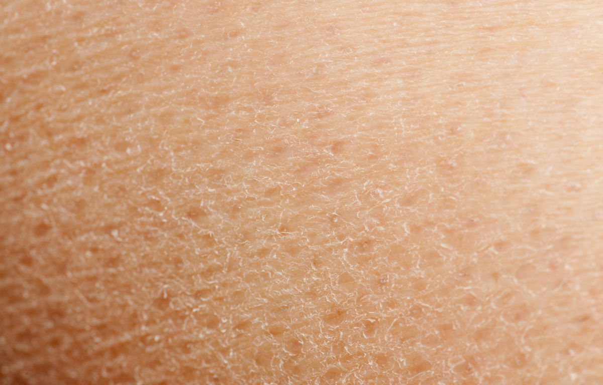 How to identify your skin type - You must know