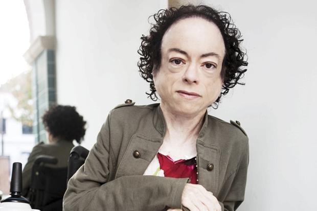 Euthanasia Prevention Coalition Euthanasia Prevention Coalition: Liz ...