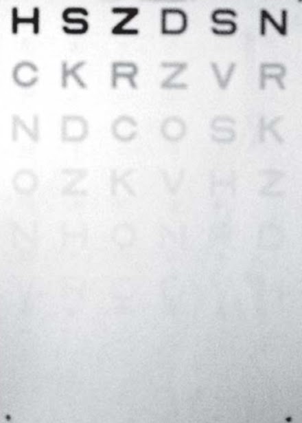 Importance of Contrast Sensitivity test in Ophthalmic practice