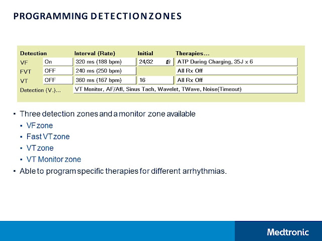 CVT Mohd Farid: Concept Of ICD Technology-Sensing & Detection-Medtronic ...