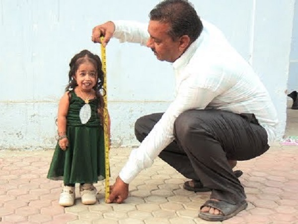 Nanismo - Entenda Suas Causas e Complicações - Saúde & Conhecimento