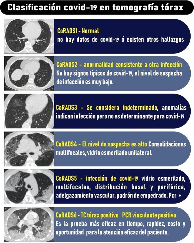 Covid_19 por Tomografía Computarizada: CLASIFICACIÓN COVID_19