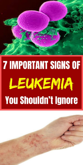 7 Important Signs of Leukemia You Shouldn’t Ignore - wellness days